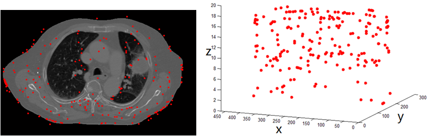 Medical Imaging Research in LSU GVC Lab