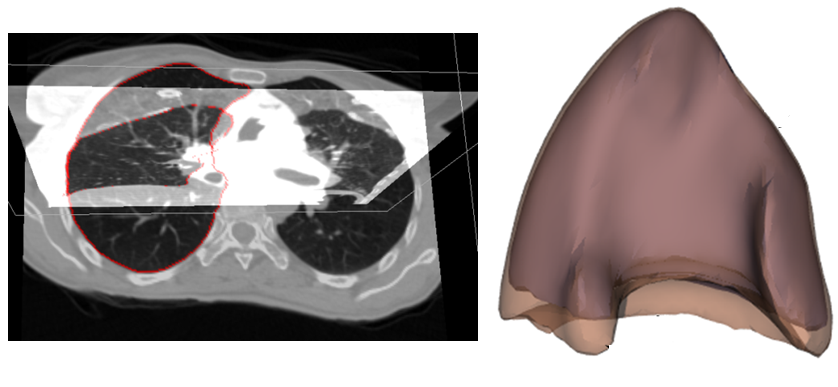 Medical Imaging Research in LSU GVC Lab