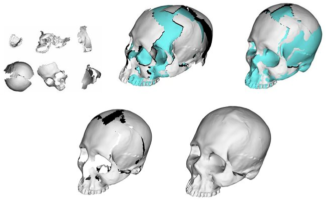 Computational Forensics: Digital Skull Restoration and Facial ...