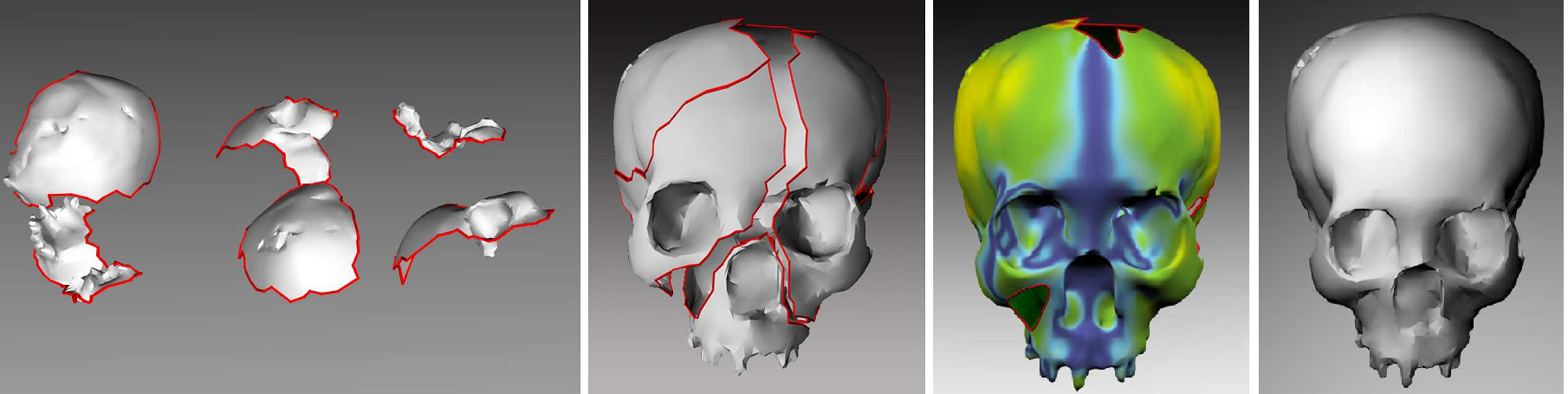 Computational Forensics: Digital Skull Restoration and Facial ...
